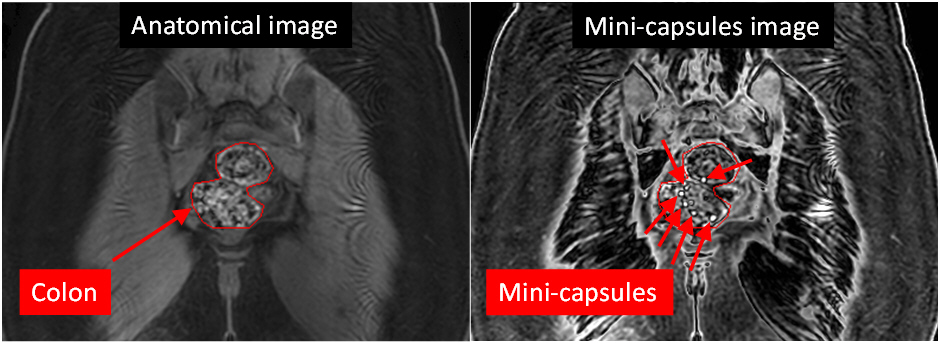 News - A new ‘Magic’ MRI test to help manage constipation in children ...