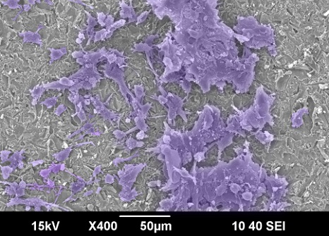 Biomaterial Coatings - The University of Nottingham